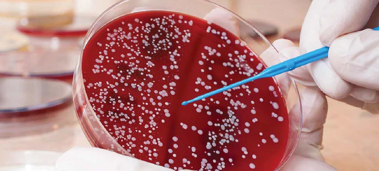 10 Early Warning Signs of Blood Cancer You Must Know | BMCHRC