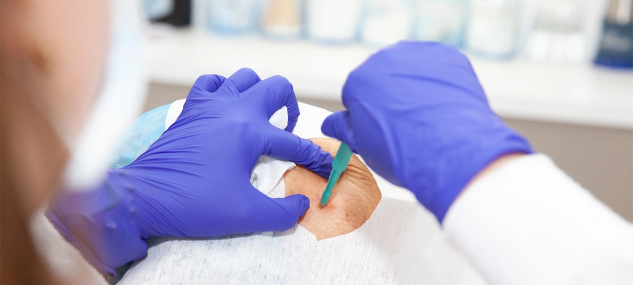 What to Expect During a Biopsy for Cancer Diagnosis | BMCHRC