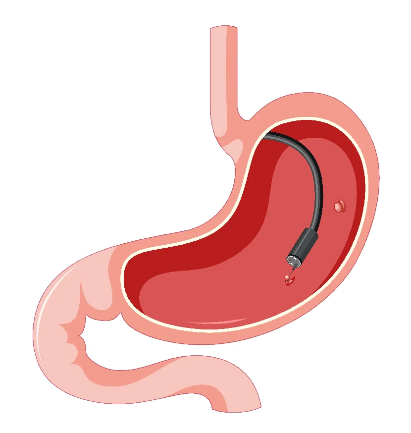 Gastroenterology Hospital in Jaipur, India | BMCHRC