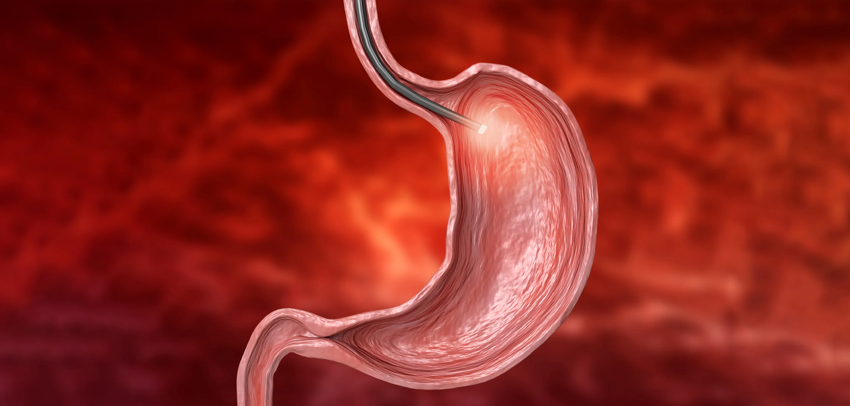 Gastroscopy & Colonoscopy Hospital in Jaipur, India | BMCHRC