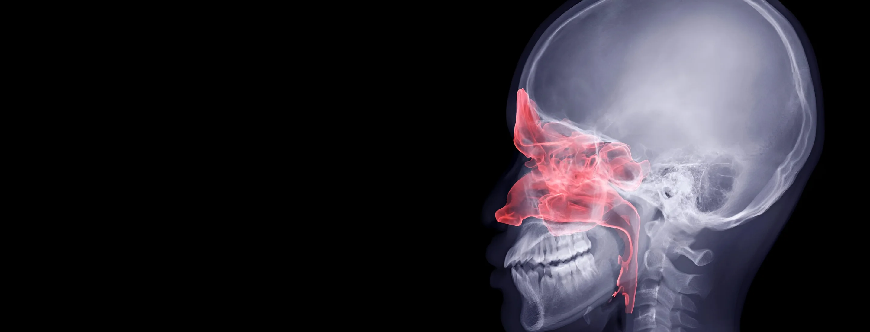 Nose & Paranasal Sinus Cancer Treatment in Jaipur, India