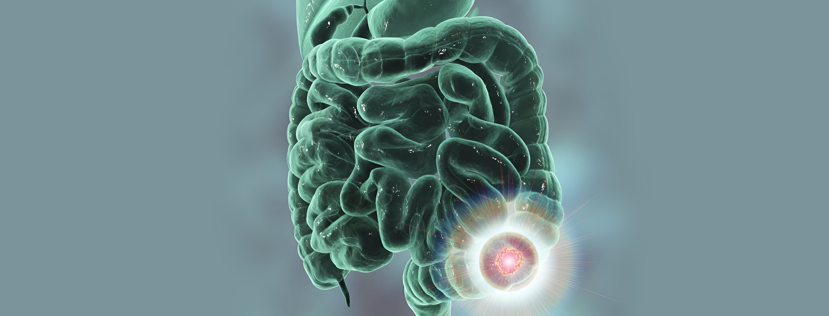 Colorectal Cancer Symptoms | Signs, Diagnosis & Types