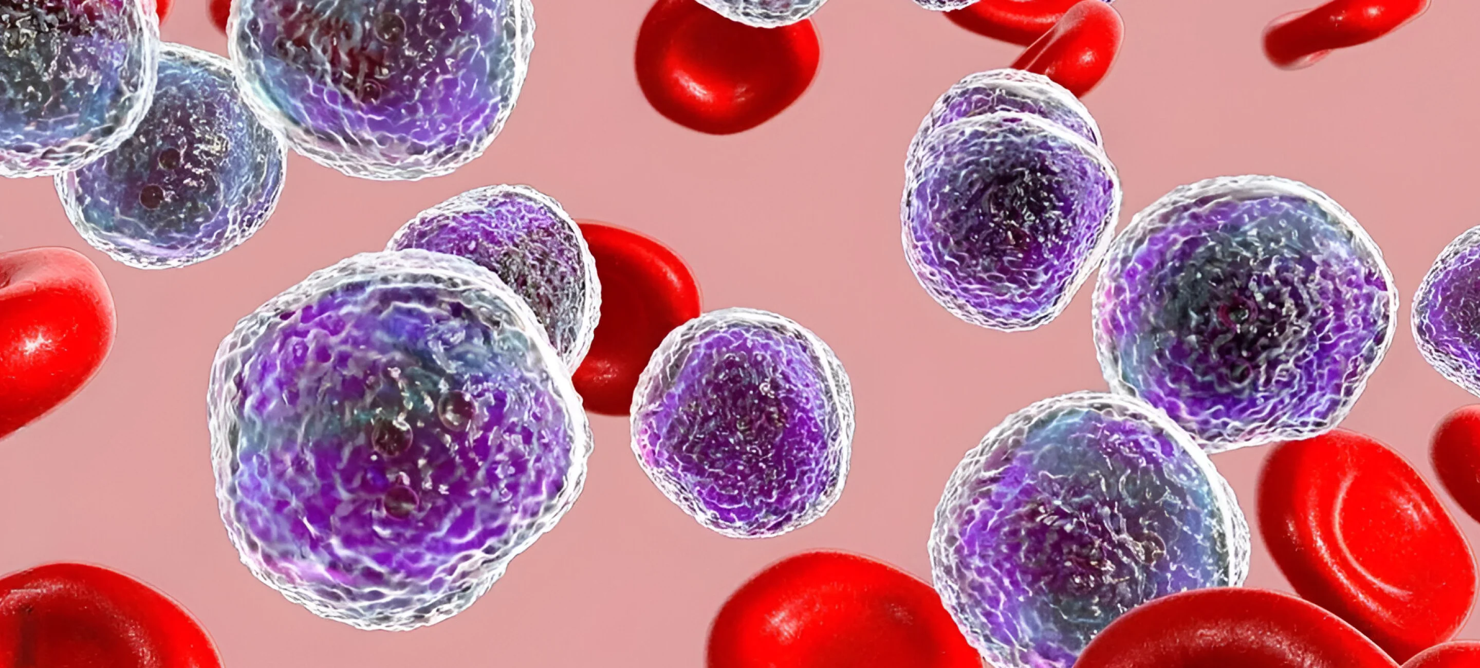 Acute Lymphoblastic Leukemia (ALL) Treatment in Jaipur | BMCHRC