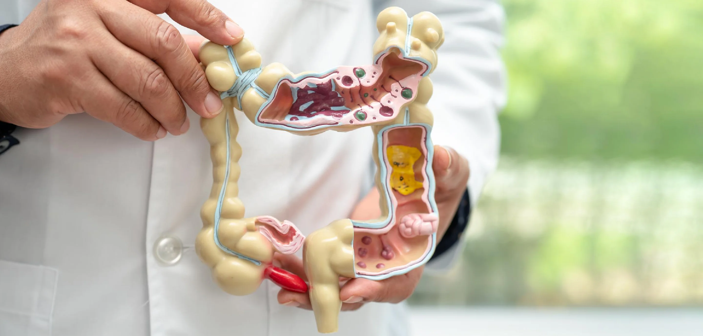 Colorectal Cancer Treatment in Jaipur, India | BMCHRC Hospital